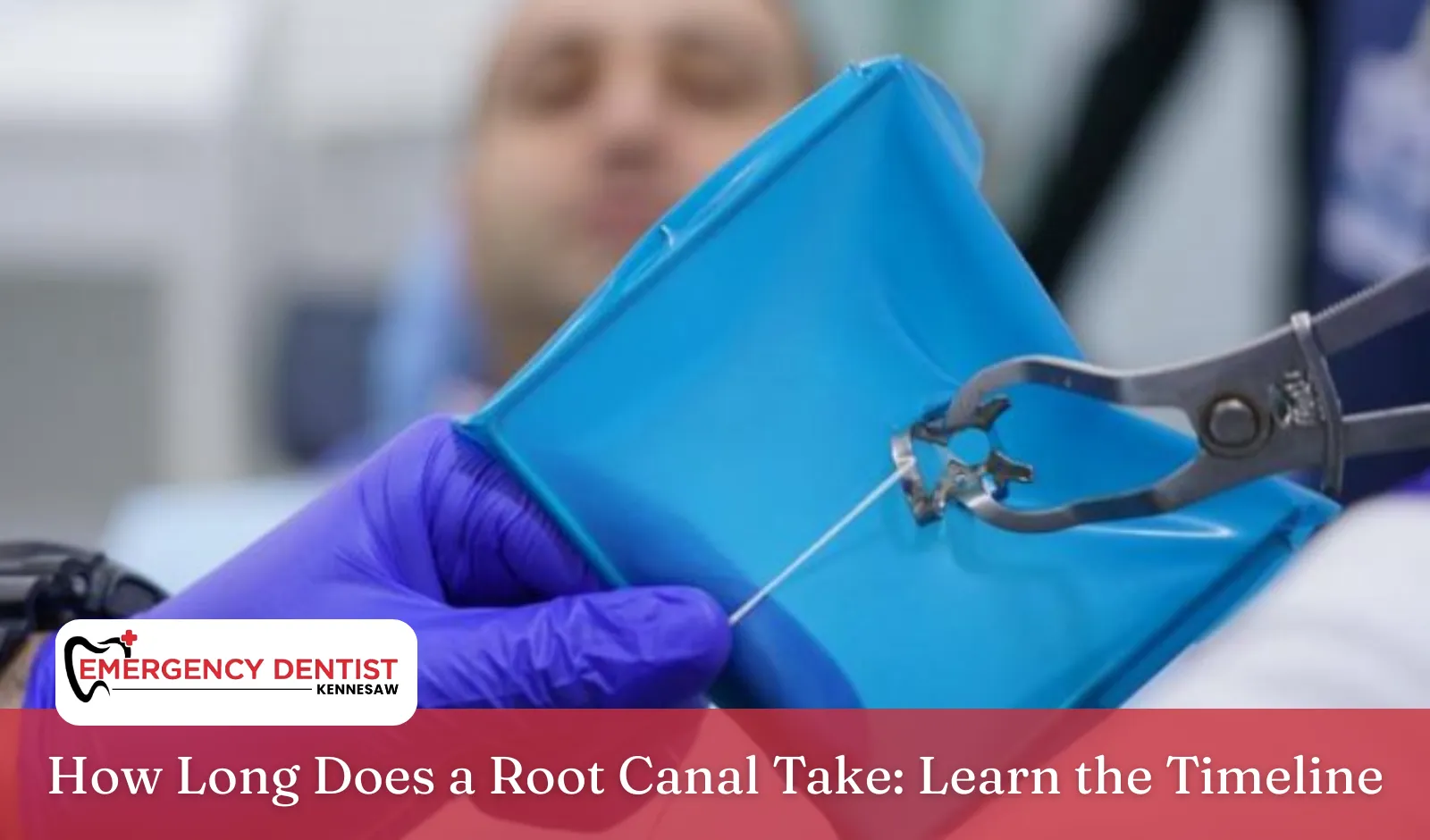 How Long Does a Root Canal Take: Learn the Timeline