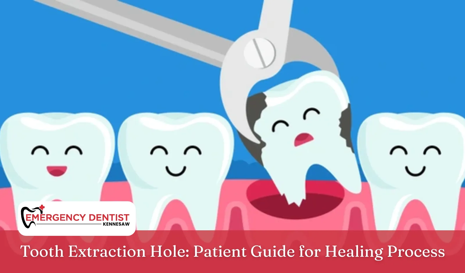Tooth Extraction Hole: Patient Guide for Healing Process